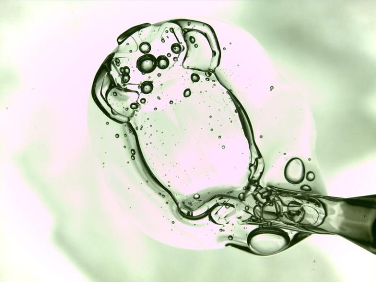 Carlevale Lens Ενδοφακός - iliasmedicals